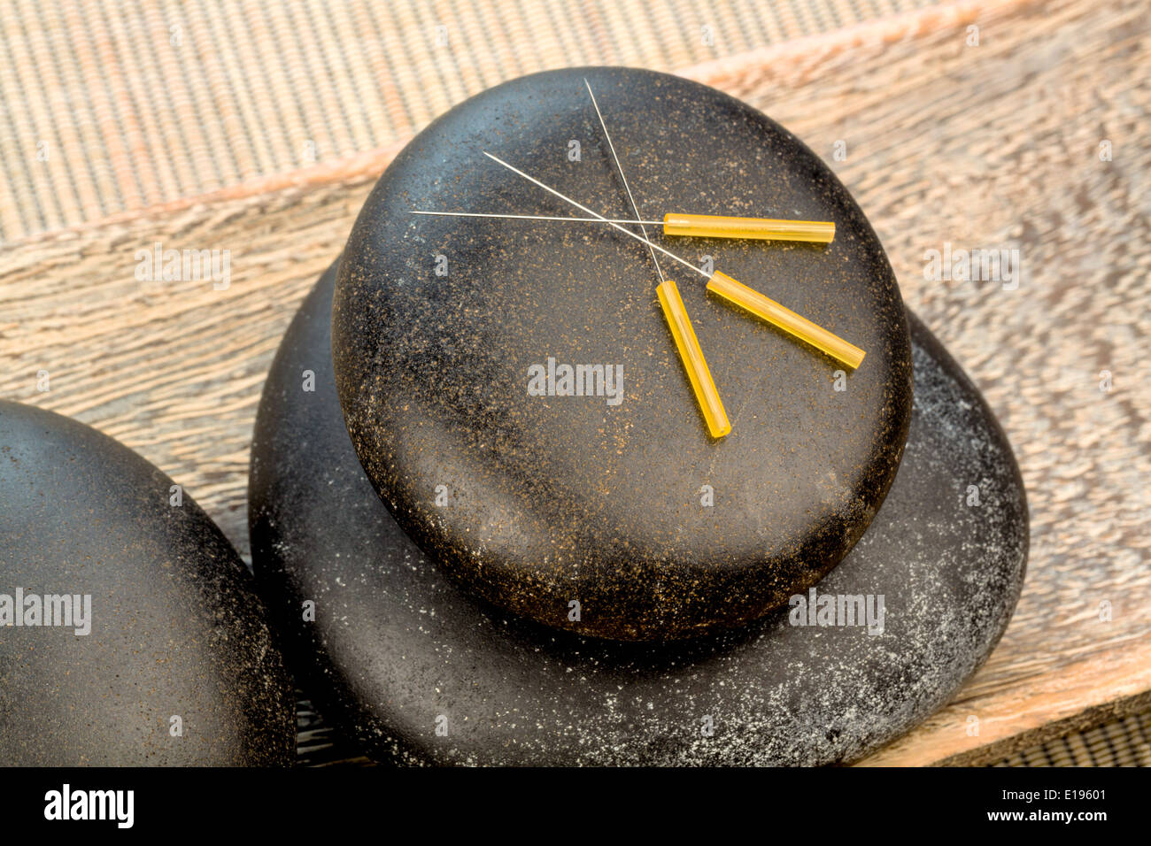 Acupuncture hi-res stock photography and images - Alamy