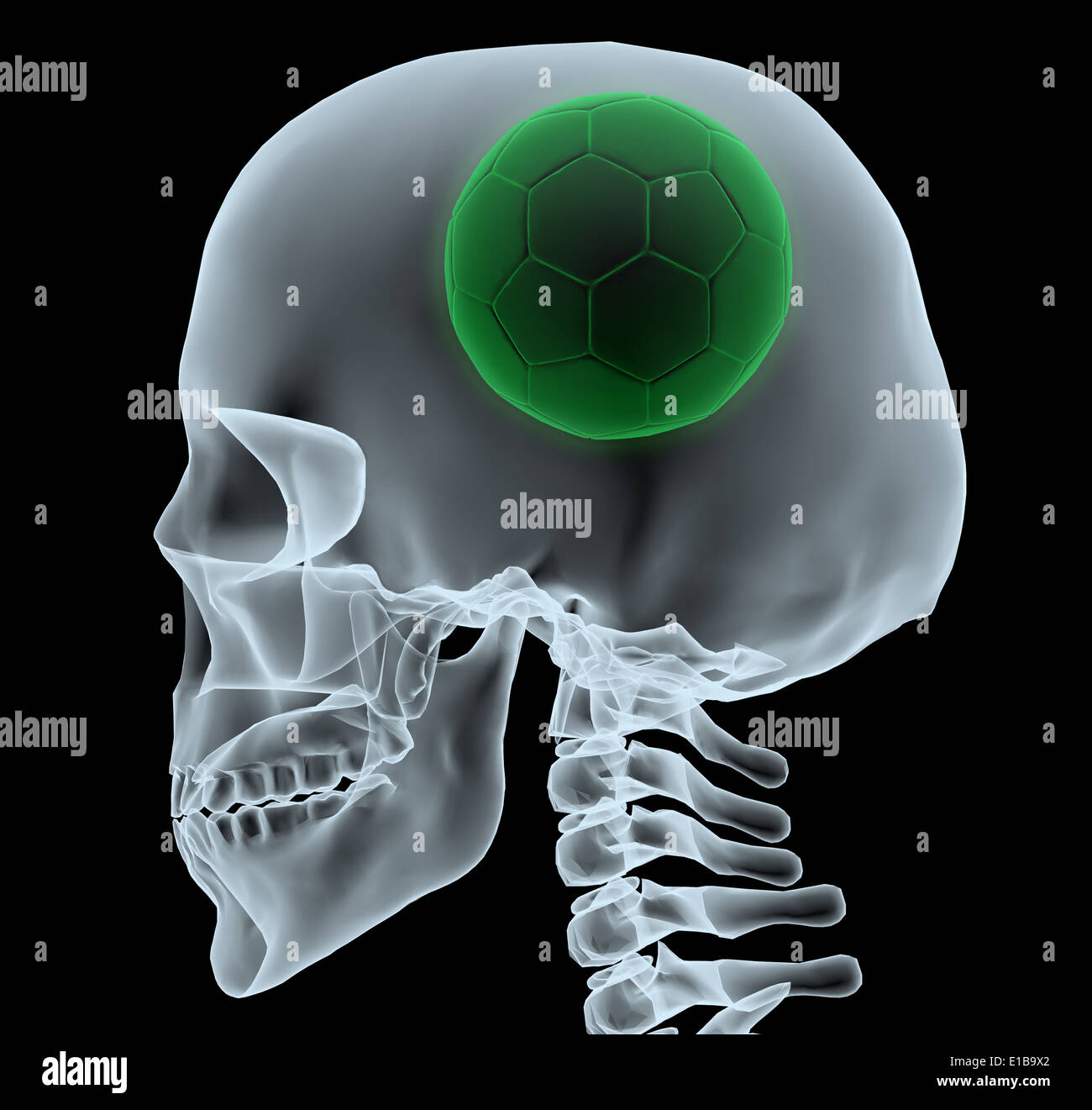 Skeleton x ray xray football soccer hi-res stock photography and images ...