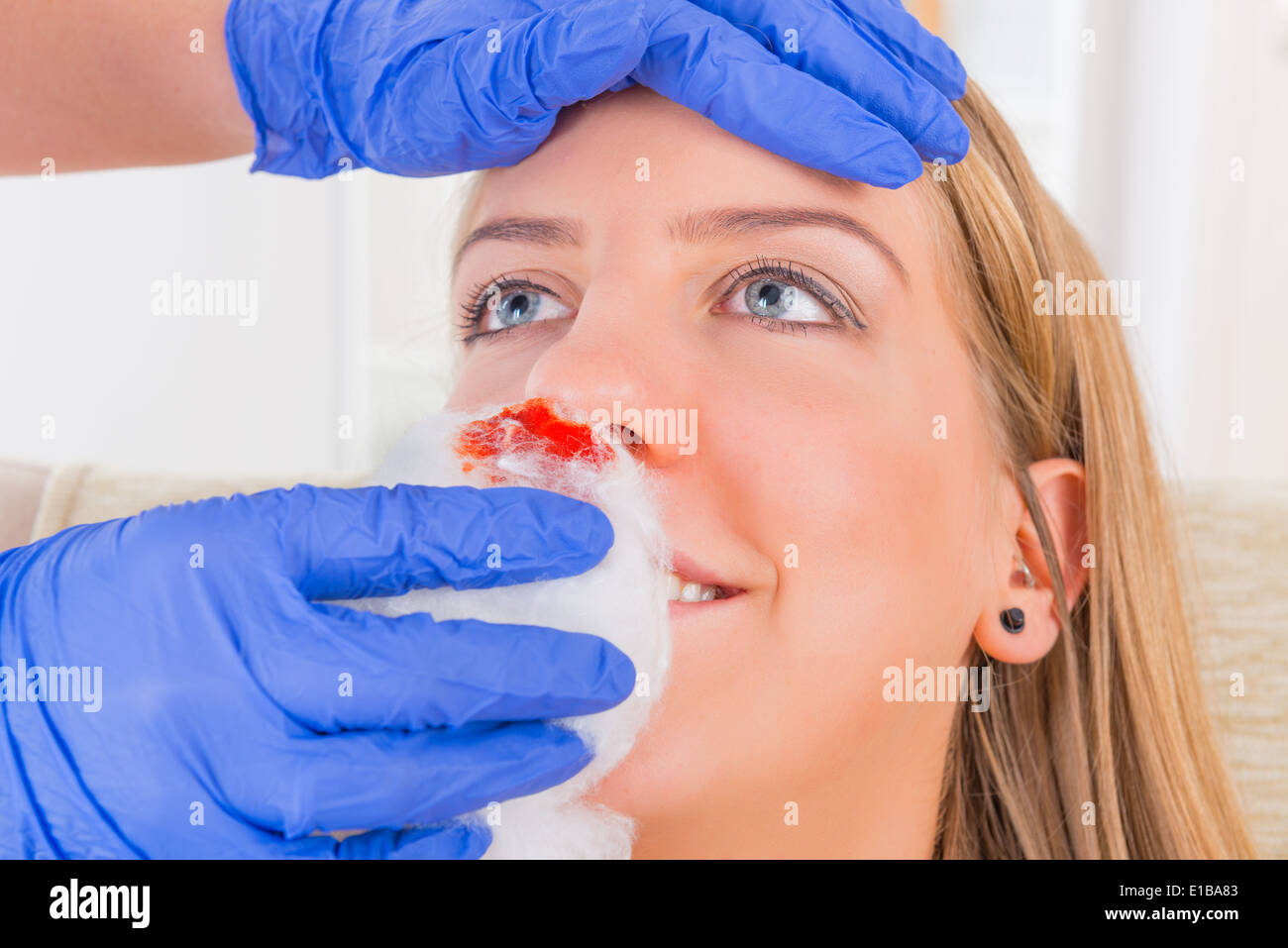 Broken nose hi-res stock photography and images - Alamy