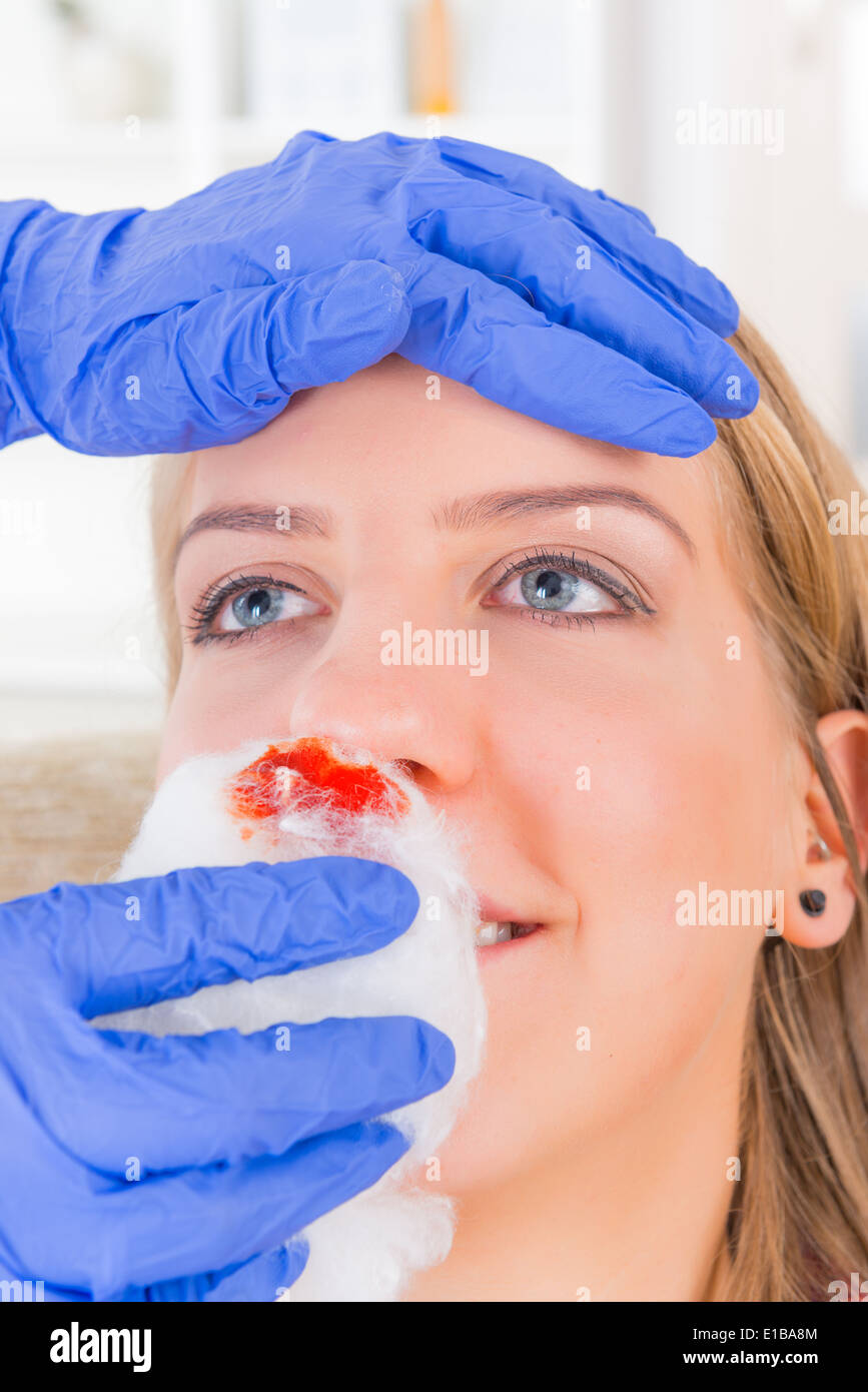 Broken nose hi-res stock photography and images - Alamy