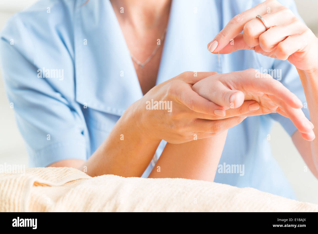Hand applying acupuncture needle Stock Photo - Alamy