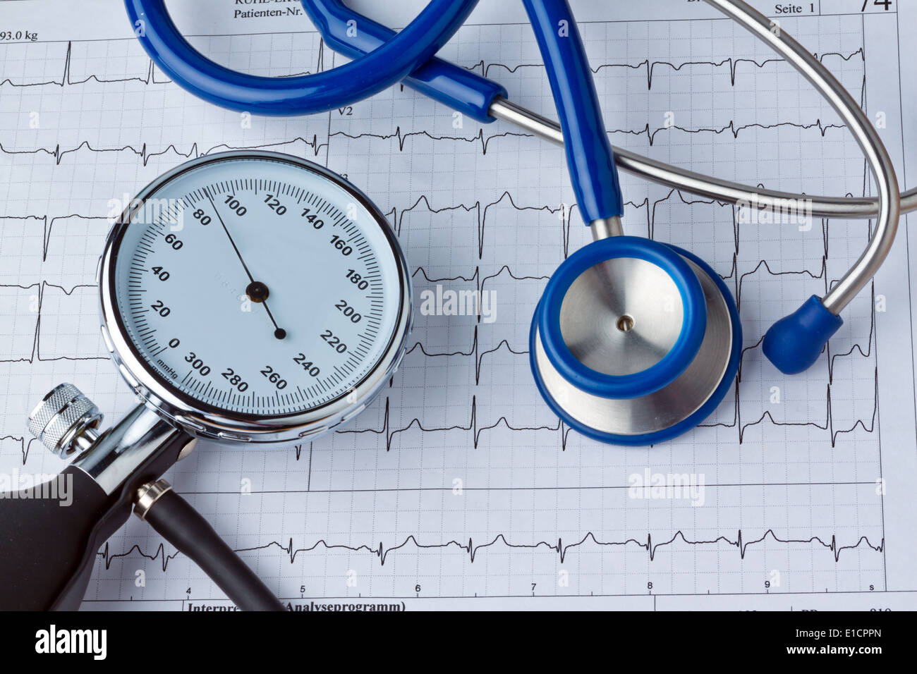 Blood pressure measurement and ECG curve. Sickness caused by high blood ...