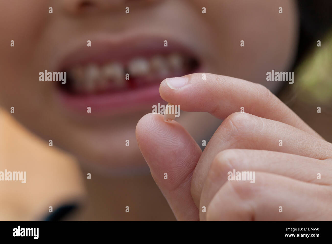 Baby with first tooth hi-res stock photography and images - Alamy
