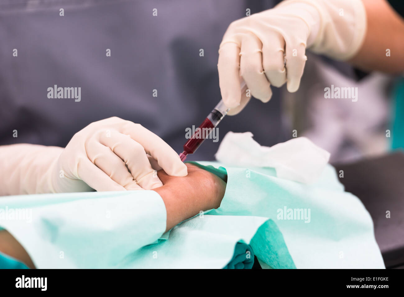 Arterial line hi-res stock photography and images - Alamy