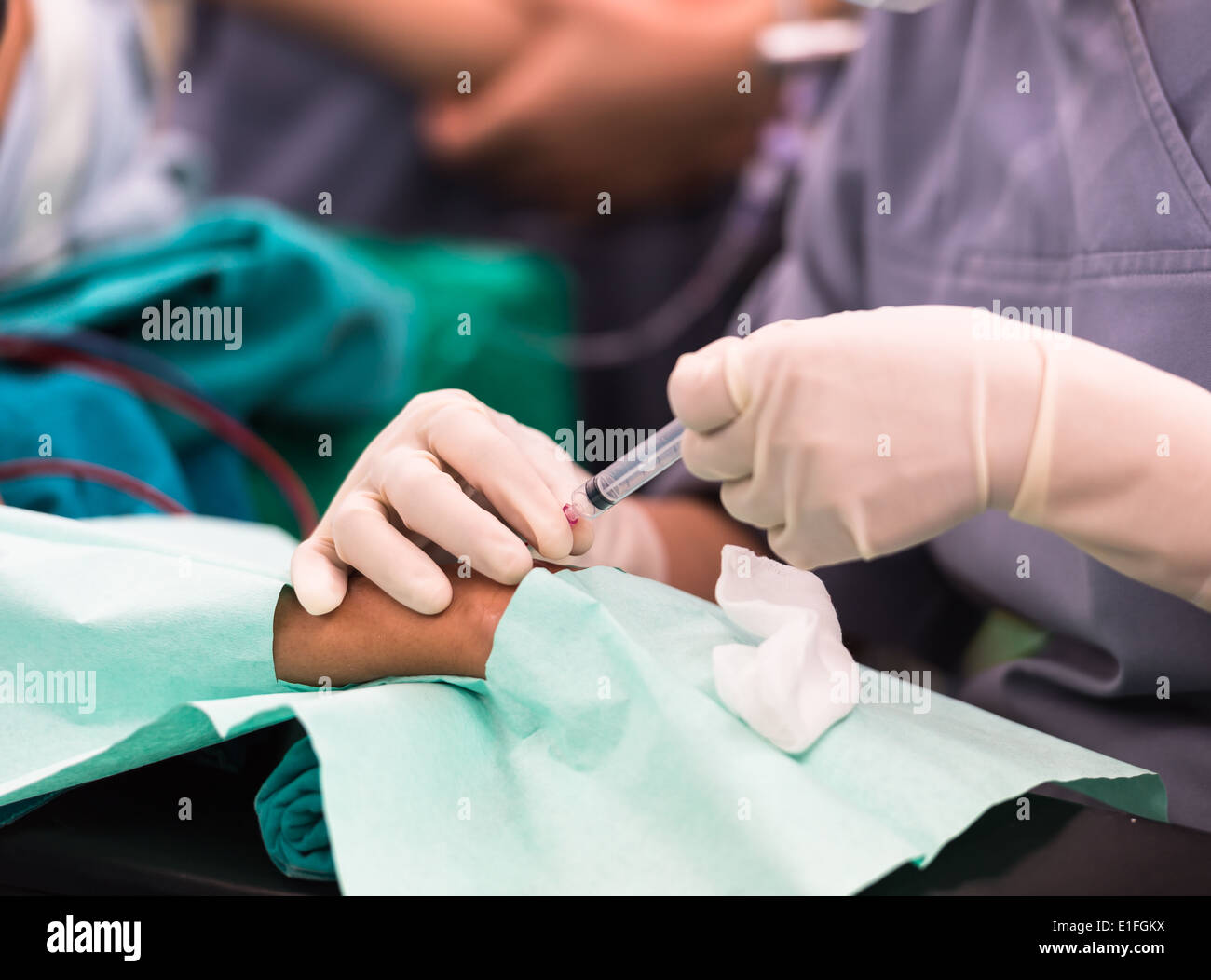 Arterial line hi-res stock photography and images - Alamy