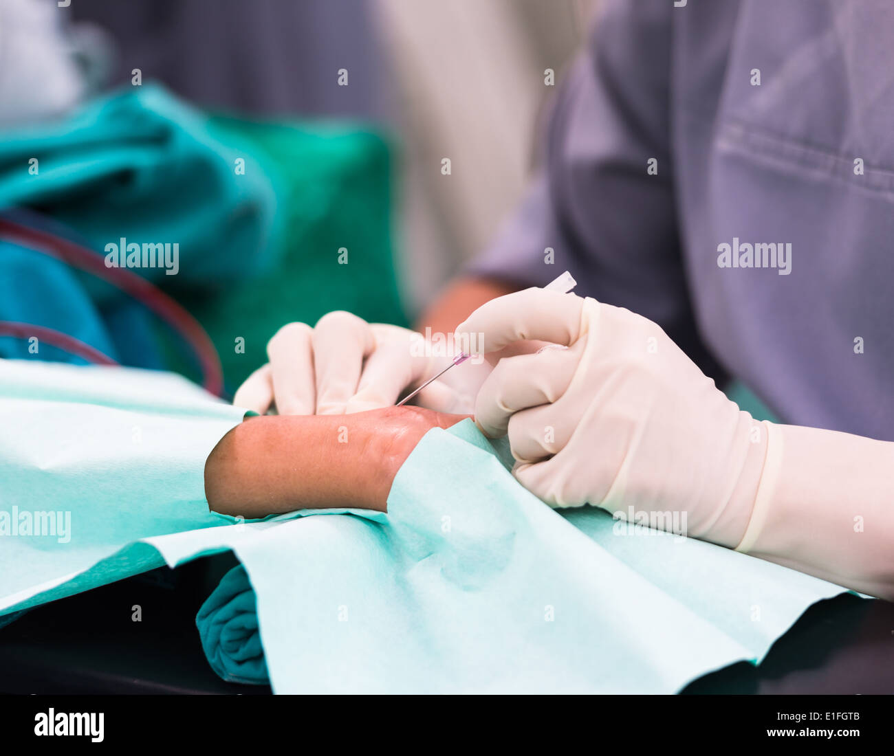Cannulation hi-res stock photography and images - Alamy