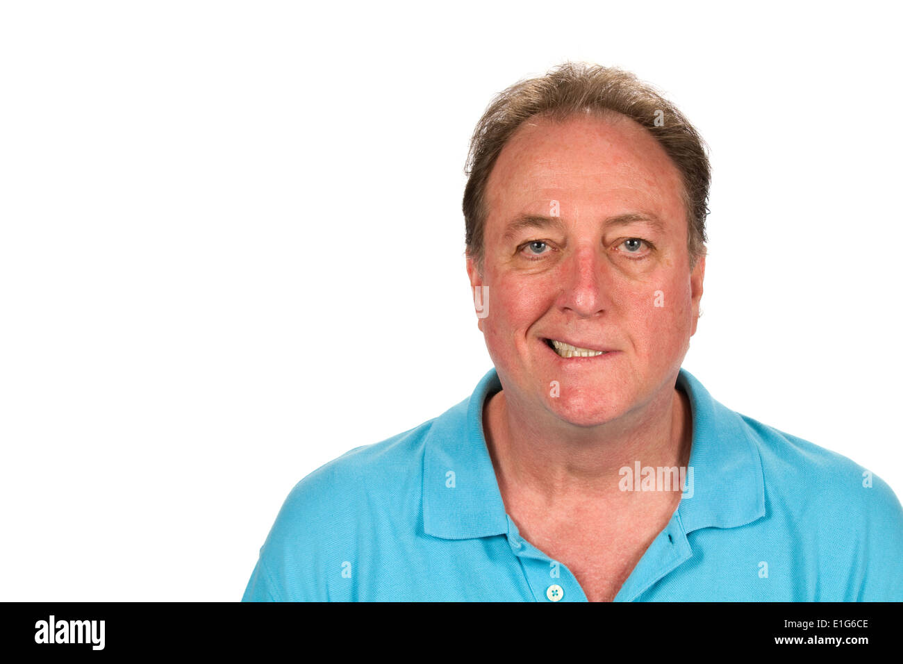 Mature man with Bell's palsy paralysis of facial the nerve Stock Photo ...