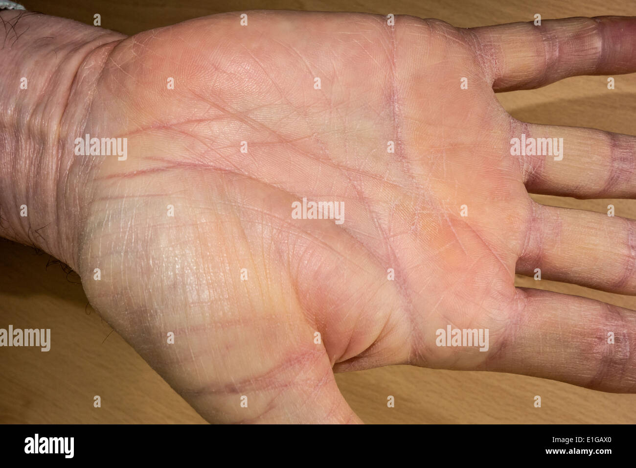 Palmistry hi-res stock photography and images - Alamy