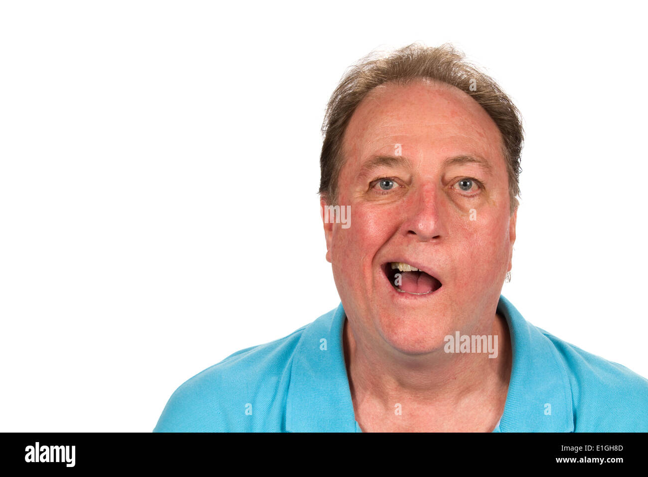 Bell's palsy hi-res stock photography and images - Alamy