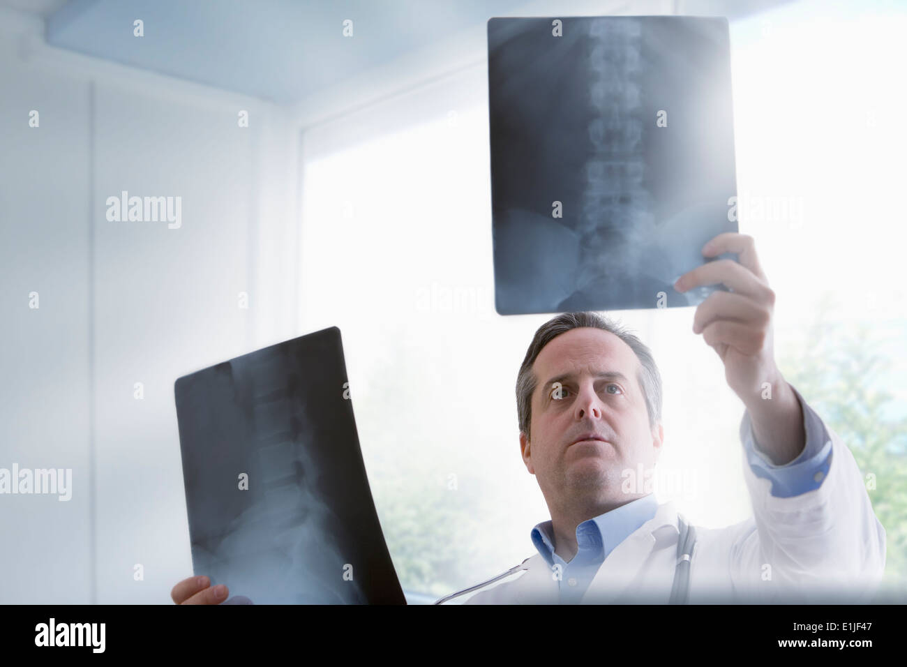 X rays hi-res stock photography and images - Alamy
