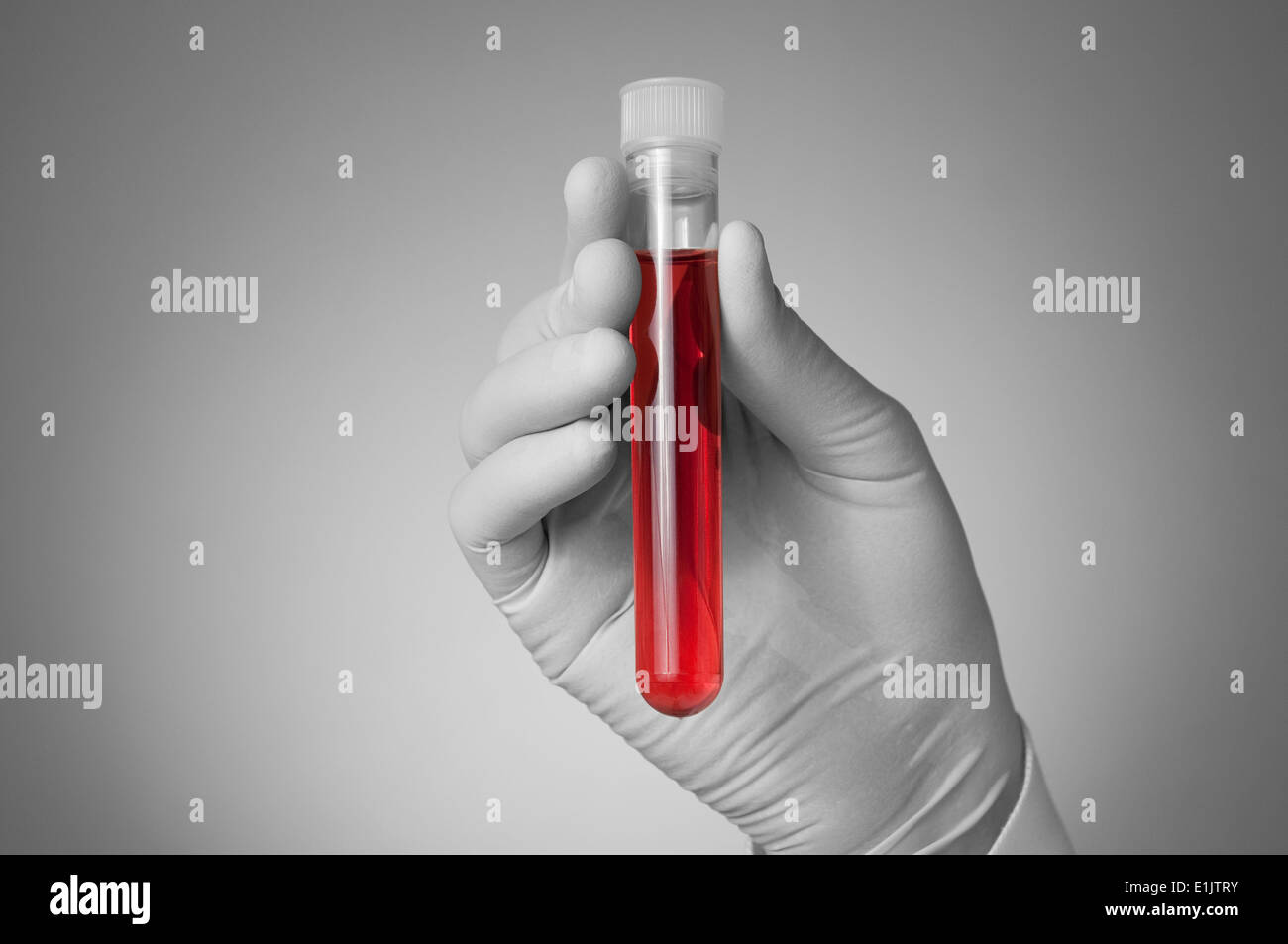Doctor holding a bottle of blood sample Stock Photo - Alamy