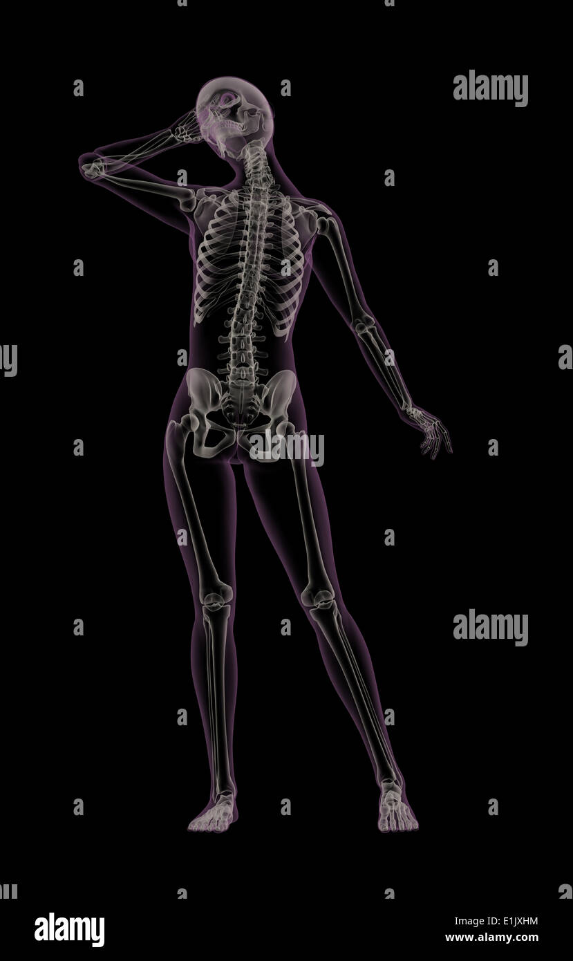 3D image of a female medical skeleton with a headache Stock Photo - Alamy