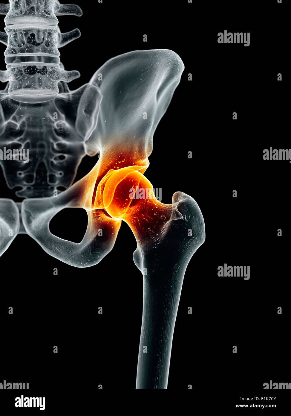 Human hip joint computer artwork Stock Photo - Alamy