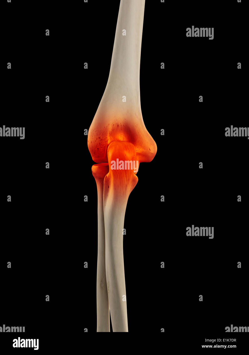 Elbow joint hi-res stock photography and images - Alamy