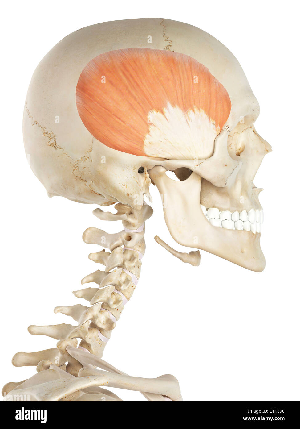 Morsicatio Buccarum Temporalis