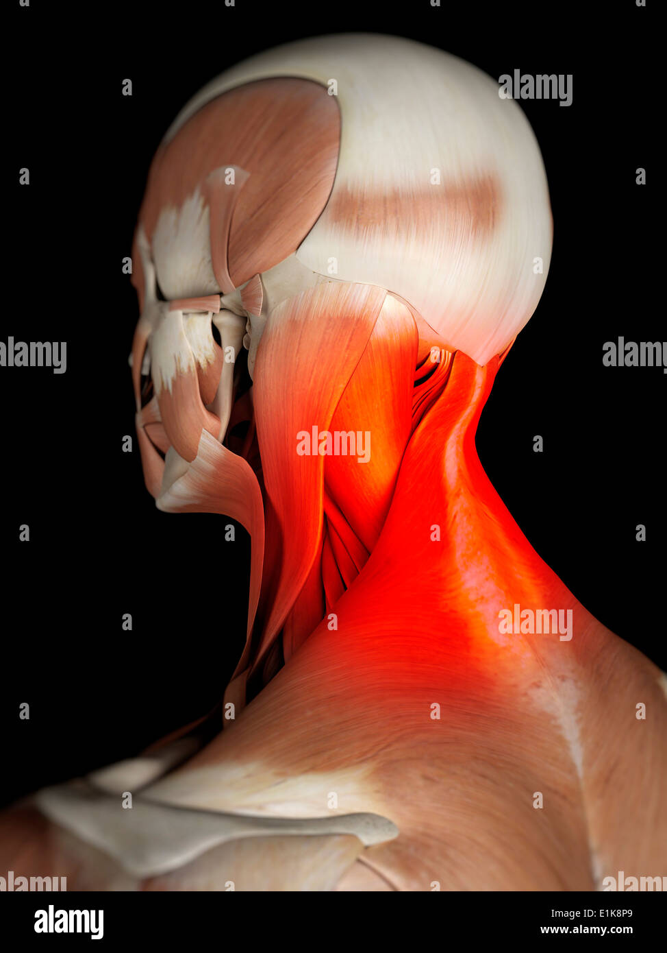Human neck muscles computer artwork Stock Photo - Alamy Human neck muscles computer artwork Stock Photo - Alamy