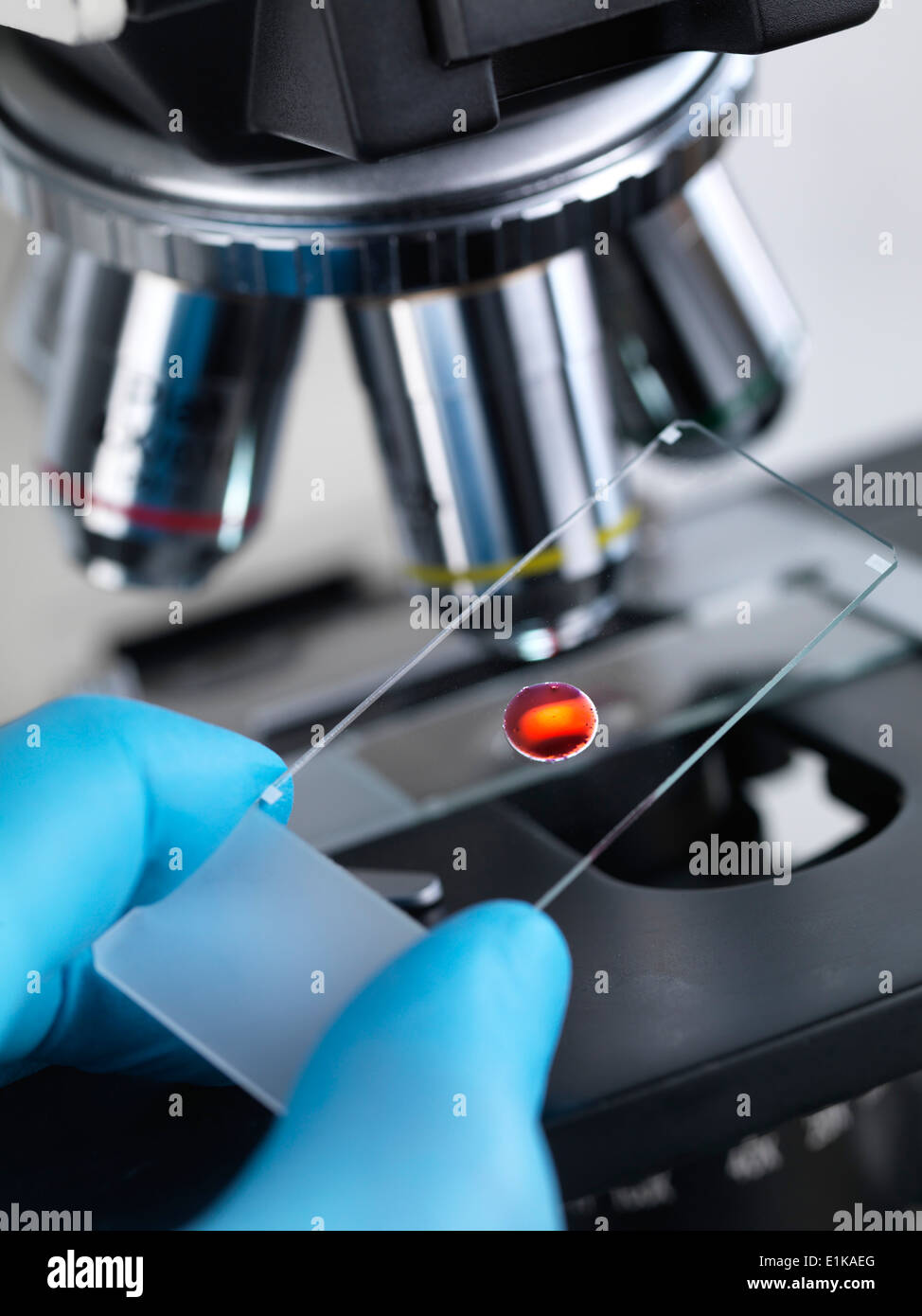 Blood sample on a microscope slide Stock Photo - Alamy