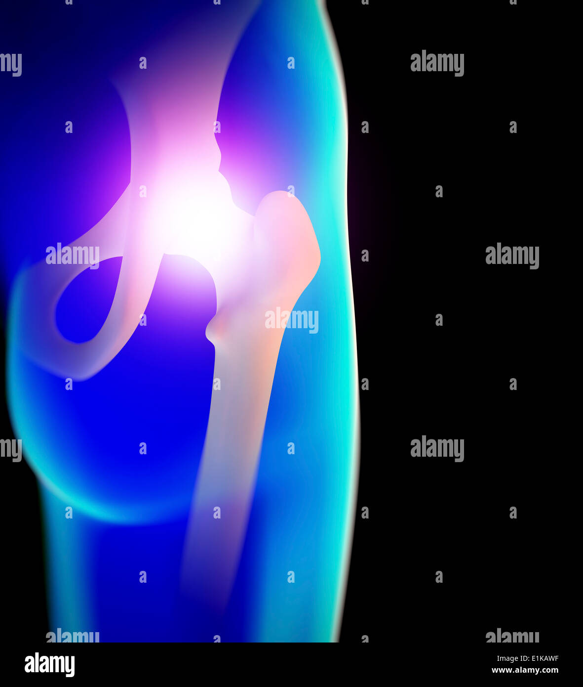 Human hip joint computer hi-res stock photography and images - Alamy