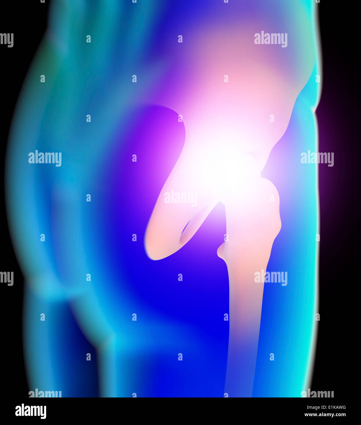 Human hip joint computer hi-res stock photography and images - Alamy