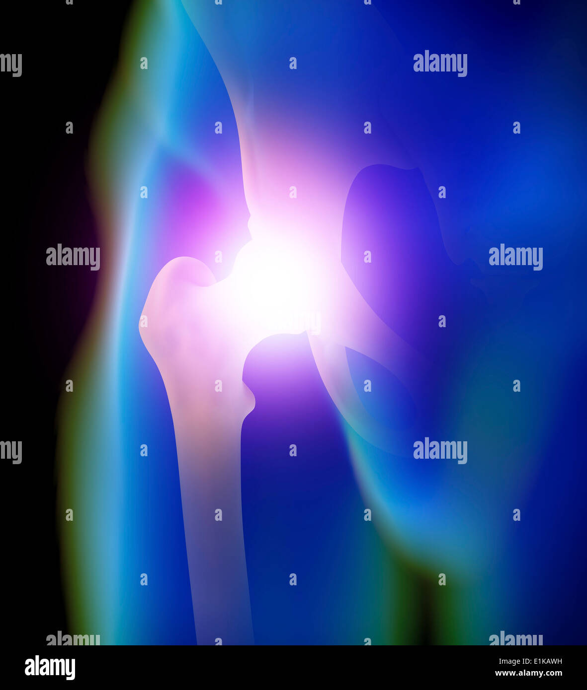 Human hip joint computer artwork Stock Photo - Alamy