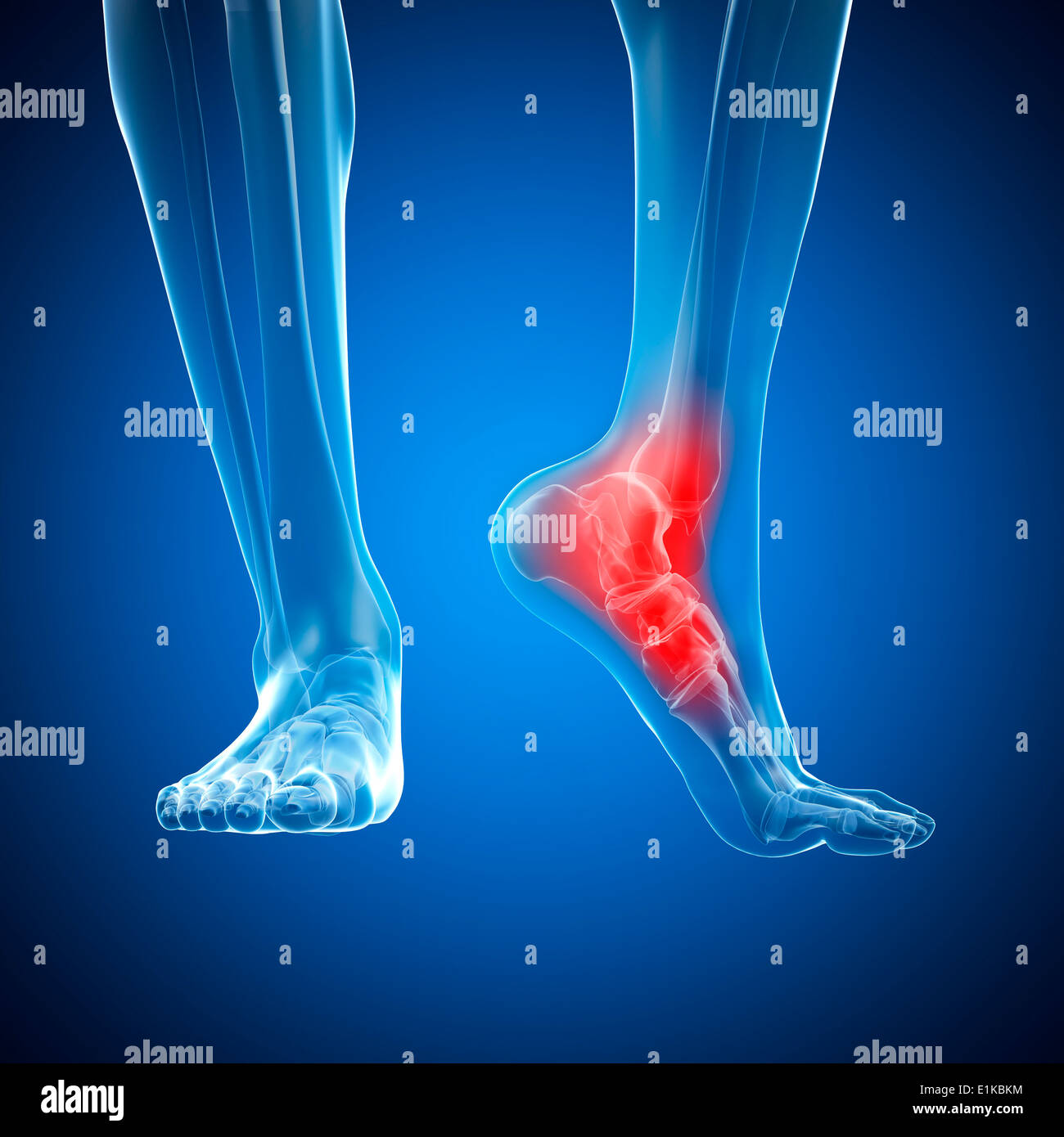 Human ankle computer artwork Stock Photo - Alamy