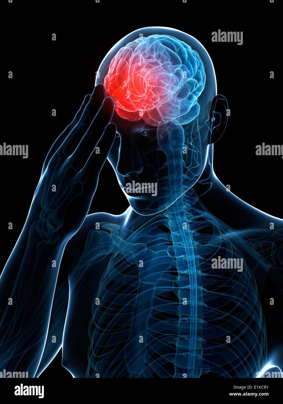Headache computer artwork Stock Photo - Alamy
