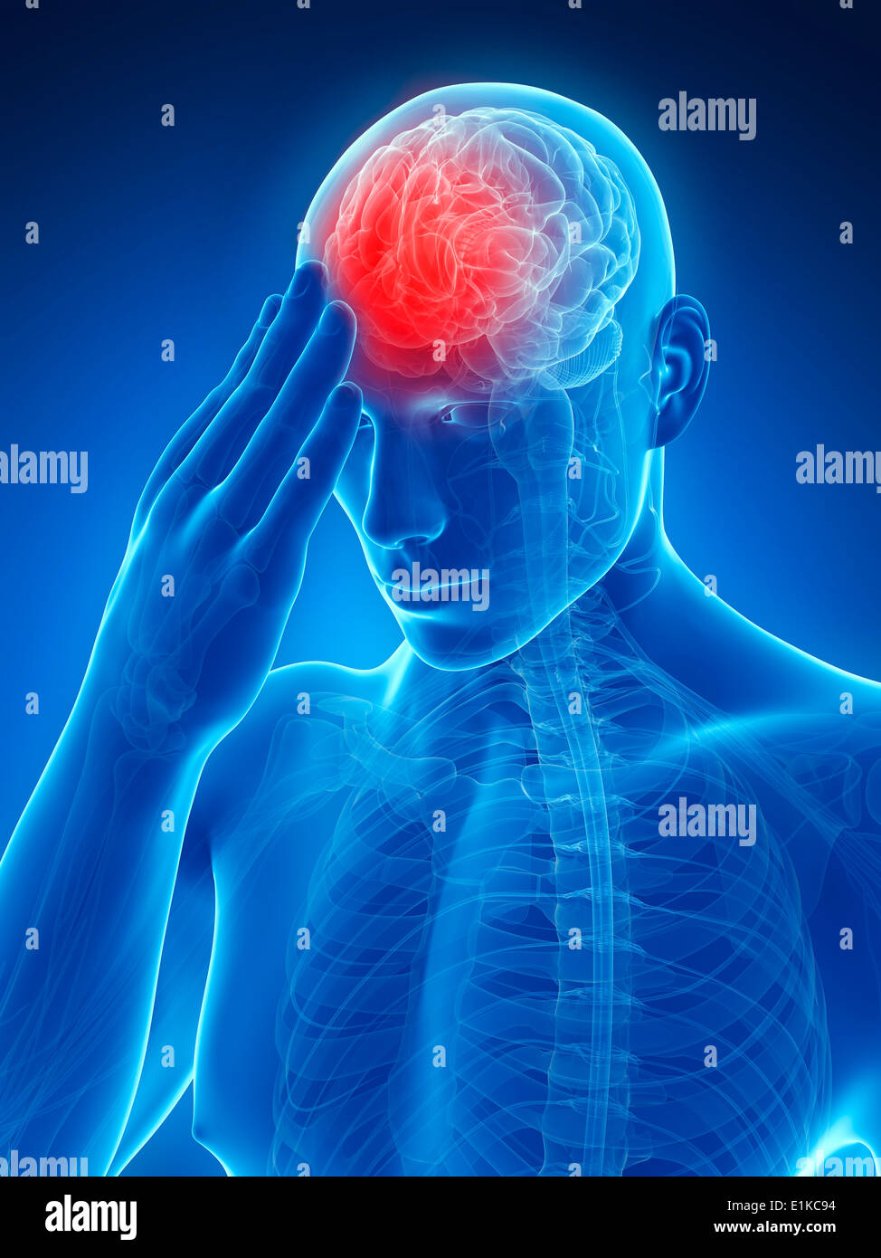 Headache computer artwork Stock Photo - Alamy