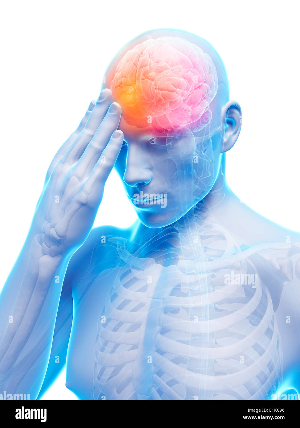 Headache computer artwork Stock Photo - Alamy