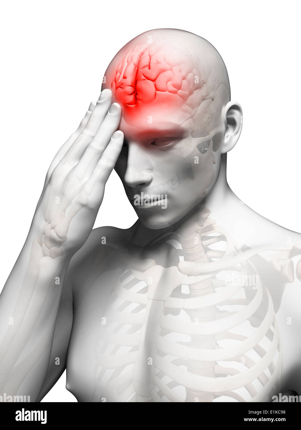 Headache computer artwork Stock Photo - Alamy