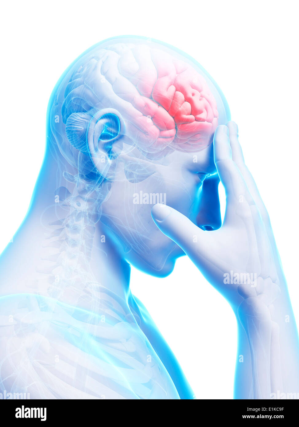 Headache computer artwork Stock Photo - Alamy