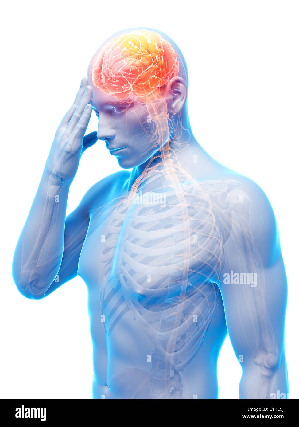 Headache computer artwork Stock Photo - Alamy