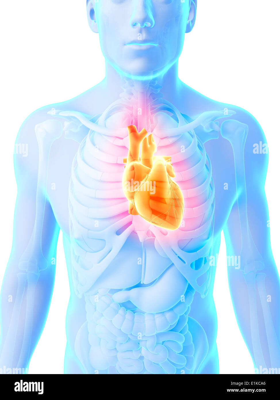 Heart attack computer artwork Stock Photo - Alamy