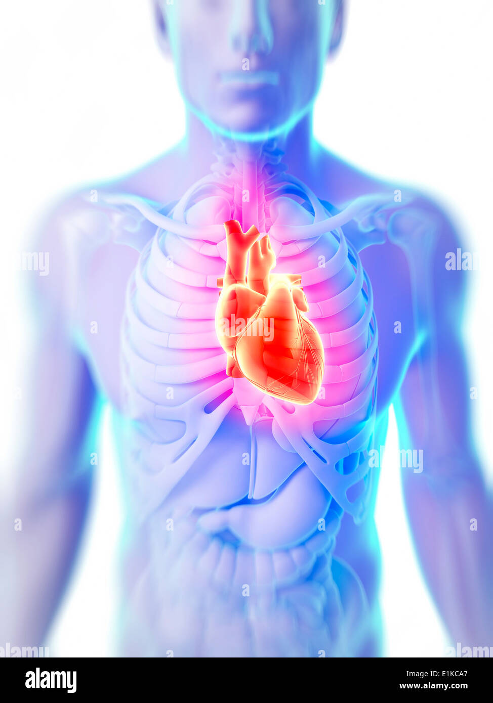 Heart attack computer artwork Stock Photo - Alamy