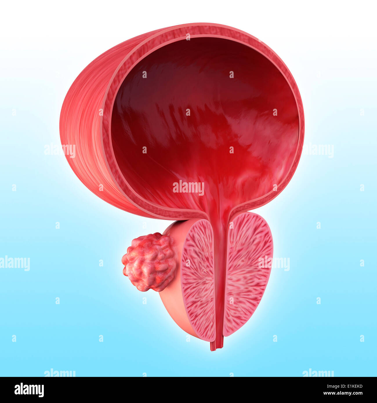 Prostate Gland Stock Photos & Prostate Gland Stock Images - Alamy