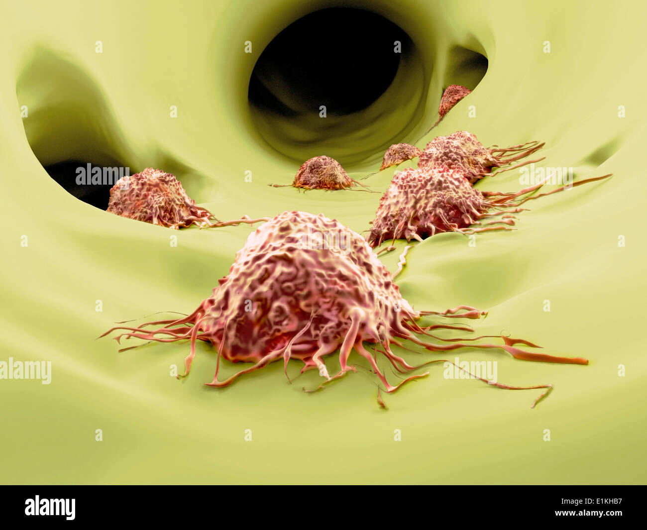 Artwork of migrating cancer cells Stock Photo - Alamy