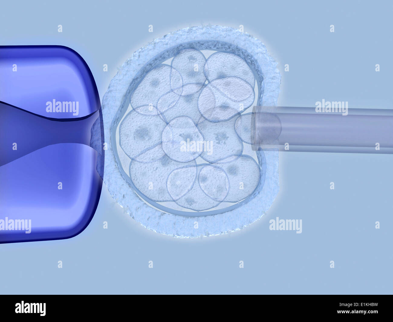 Artwork of preimplantation genetic diagnosis (PID Stock Photo - Alamy