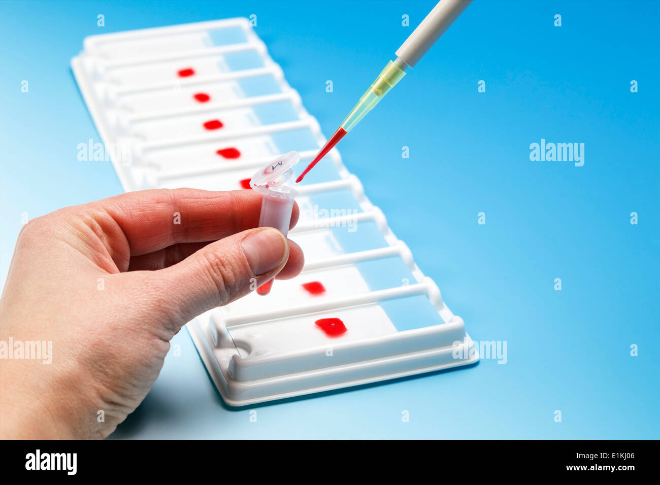 Person dropping blood sample into a vial with a pipette Stock Photo - Alamy