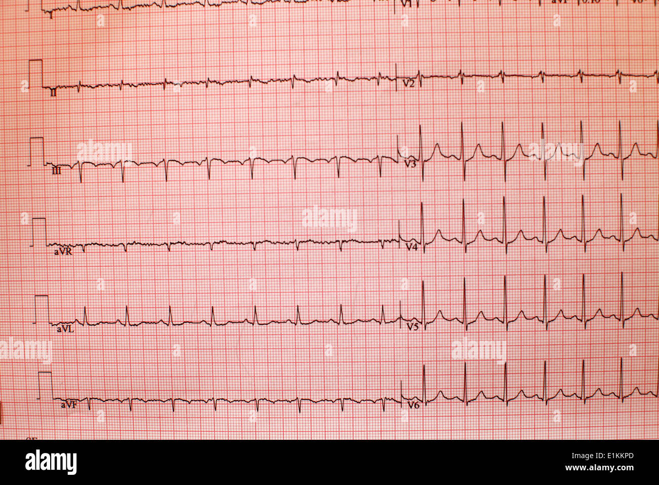 Stress Test High Resolution Stock Photography and Images - Alamy