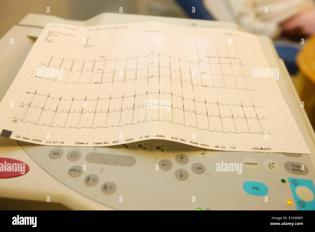Electrocardiogram High Resolution Stock Photography and Images - Alamy
