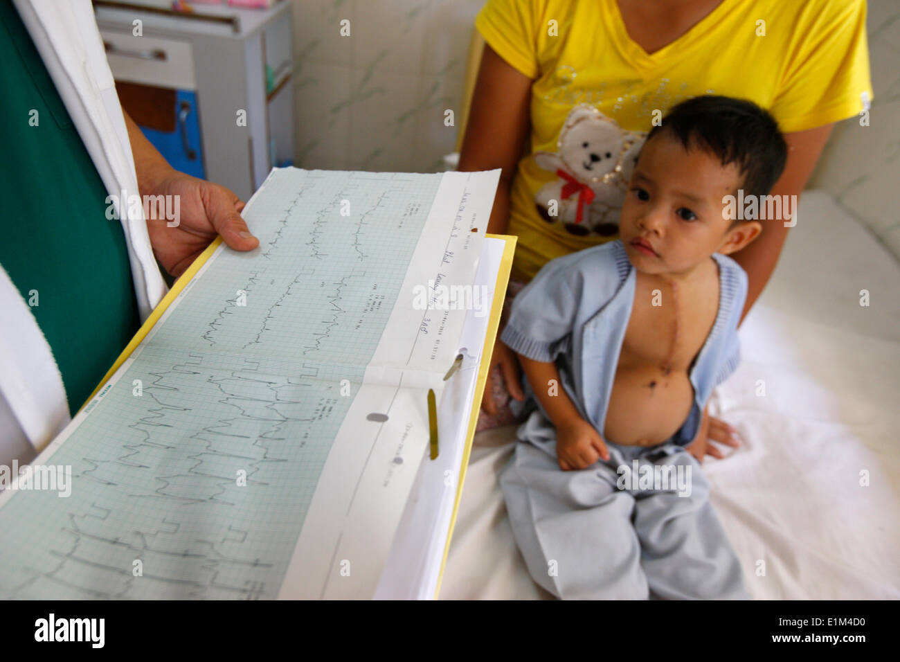 Children's ward in Phnom Penh cardiac hospital Stock Photo - Alamy