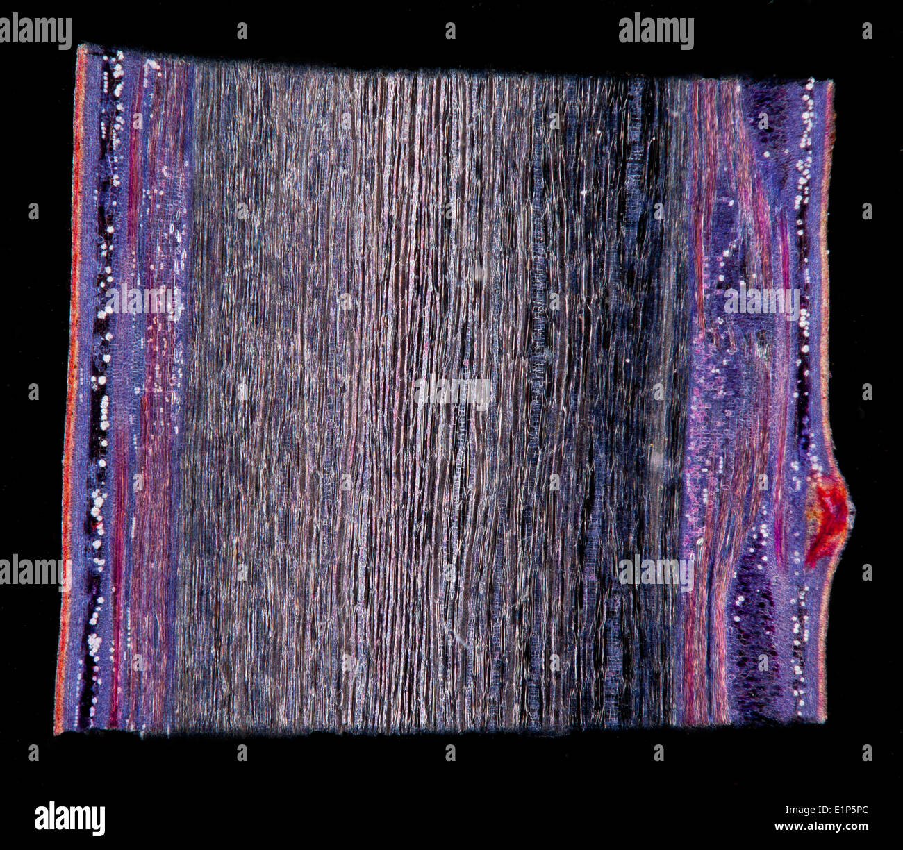 Microscope Xylem Phloem Vascular Bundles Darkfield Photomicrograph High ...
