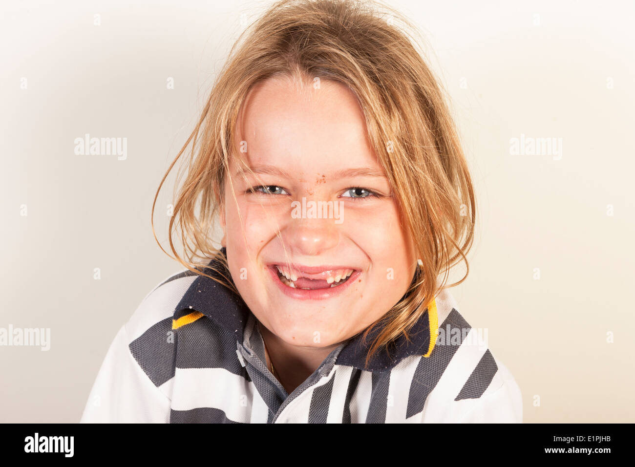Young girl with dirty face missing her front teeth Stock Photo - Alamy