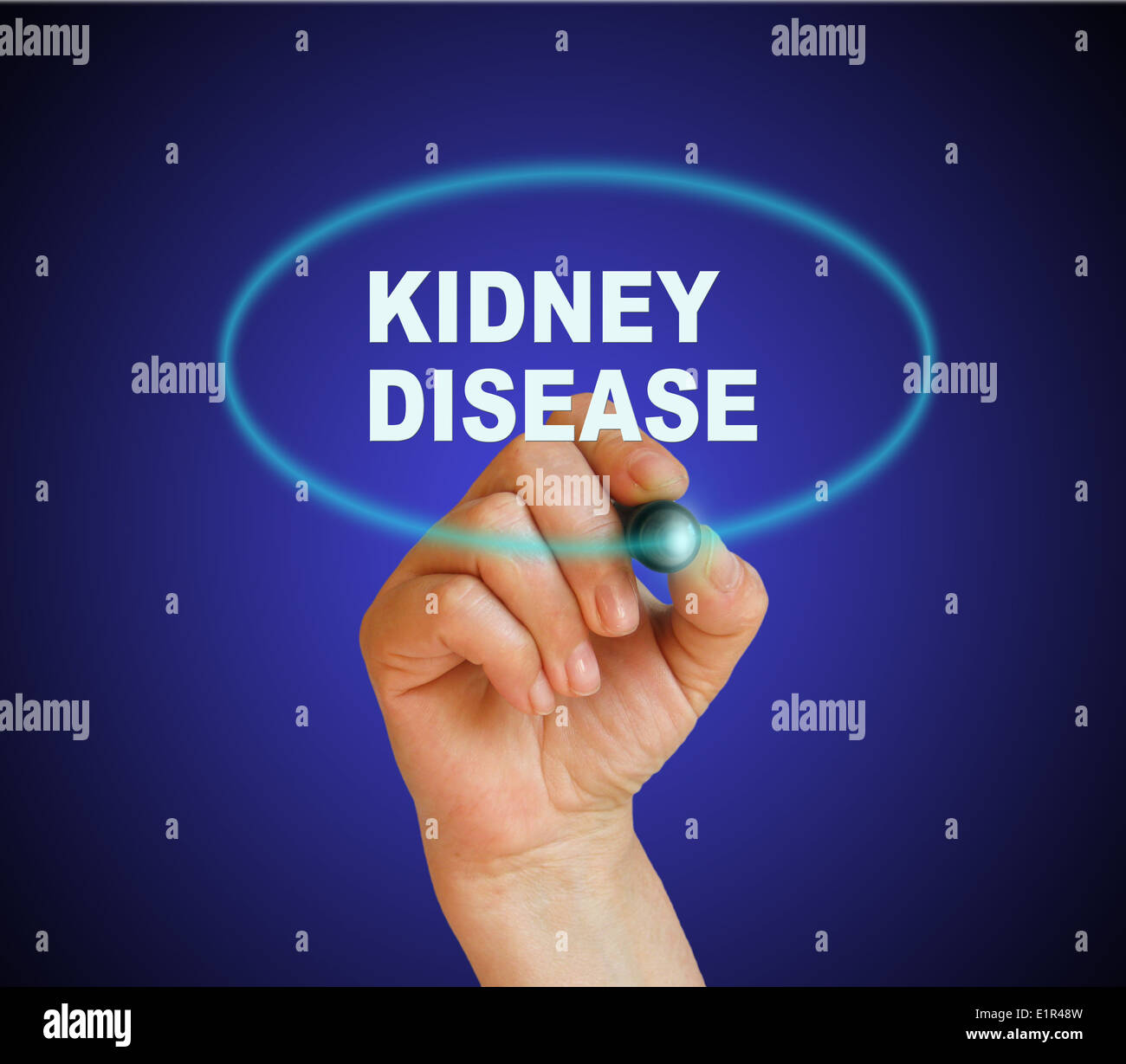 writing word KIDNEY DISEASE with marker on gradient background made in ...