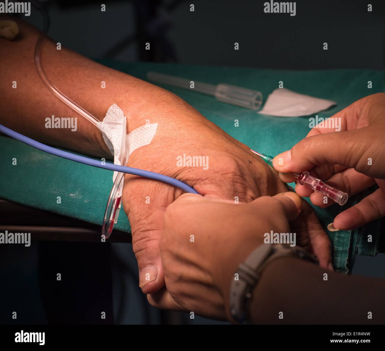 Intravenous drip arm hi-res stock photography and images - Alamy