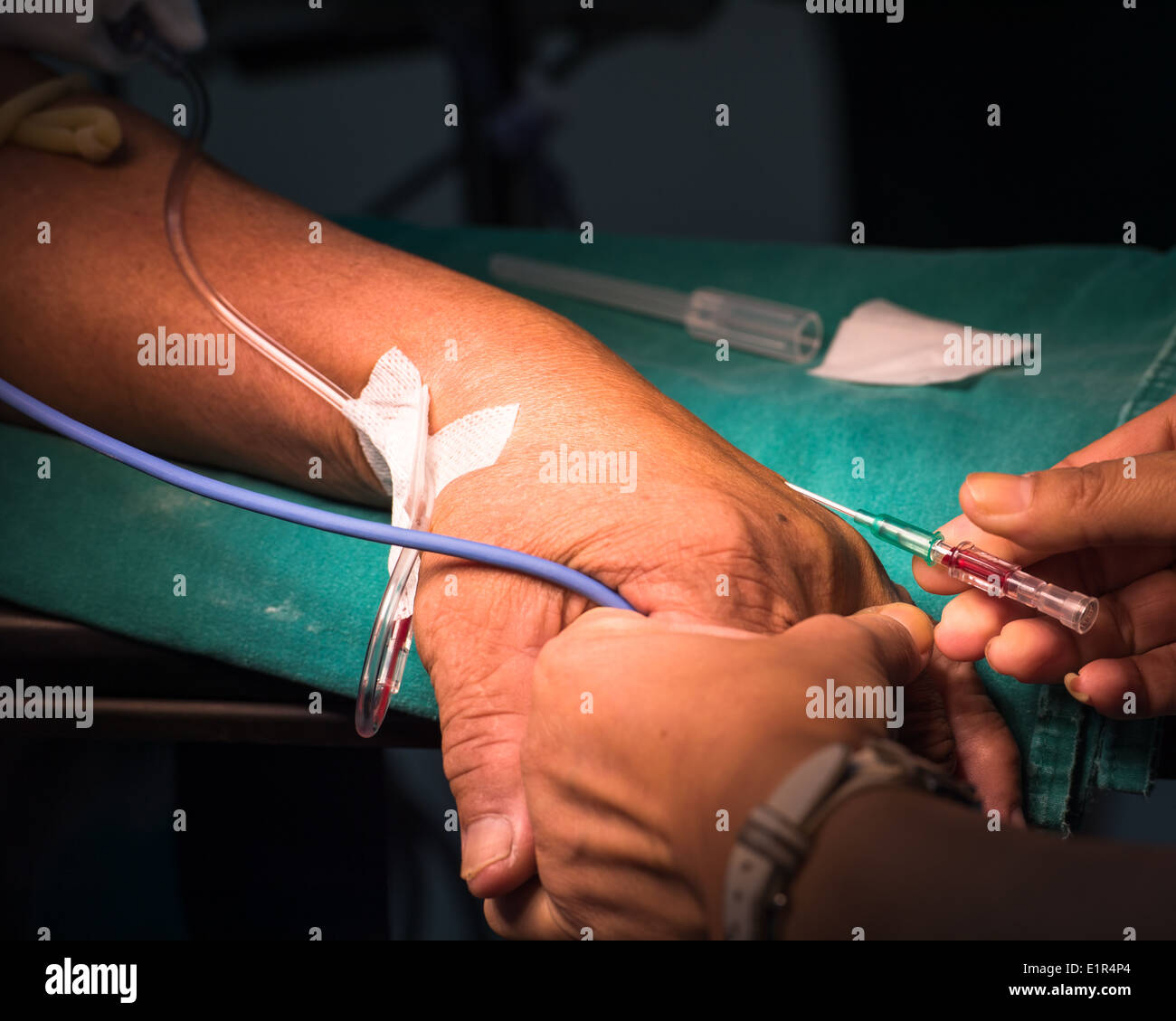 Open intravenous fluid Stock Photo - Alamy