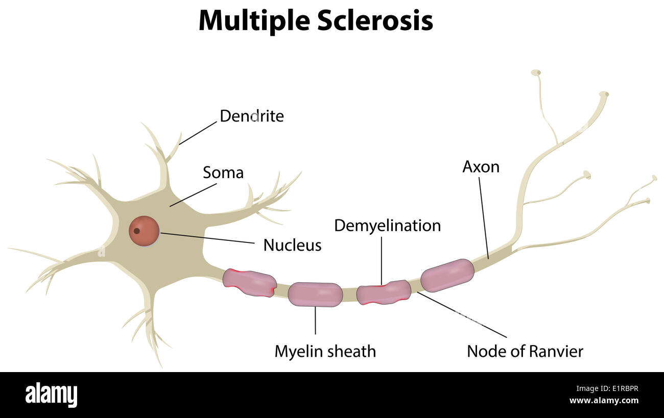 Myelin and multiple sclerosis hi-res stock photography and images - Alamy