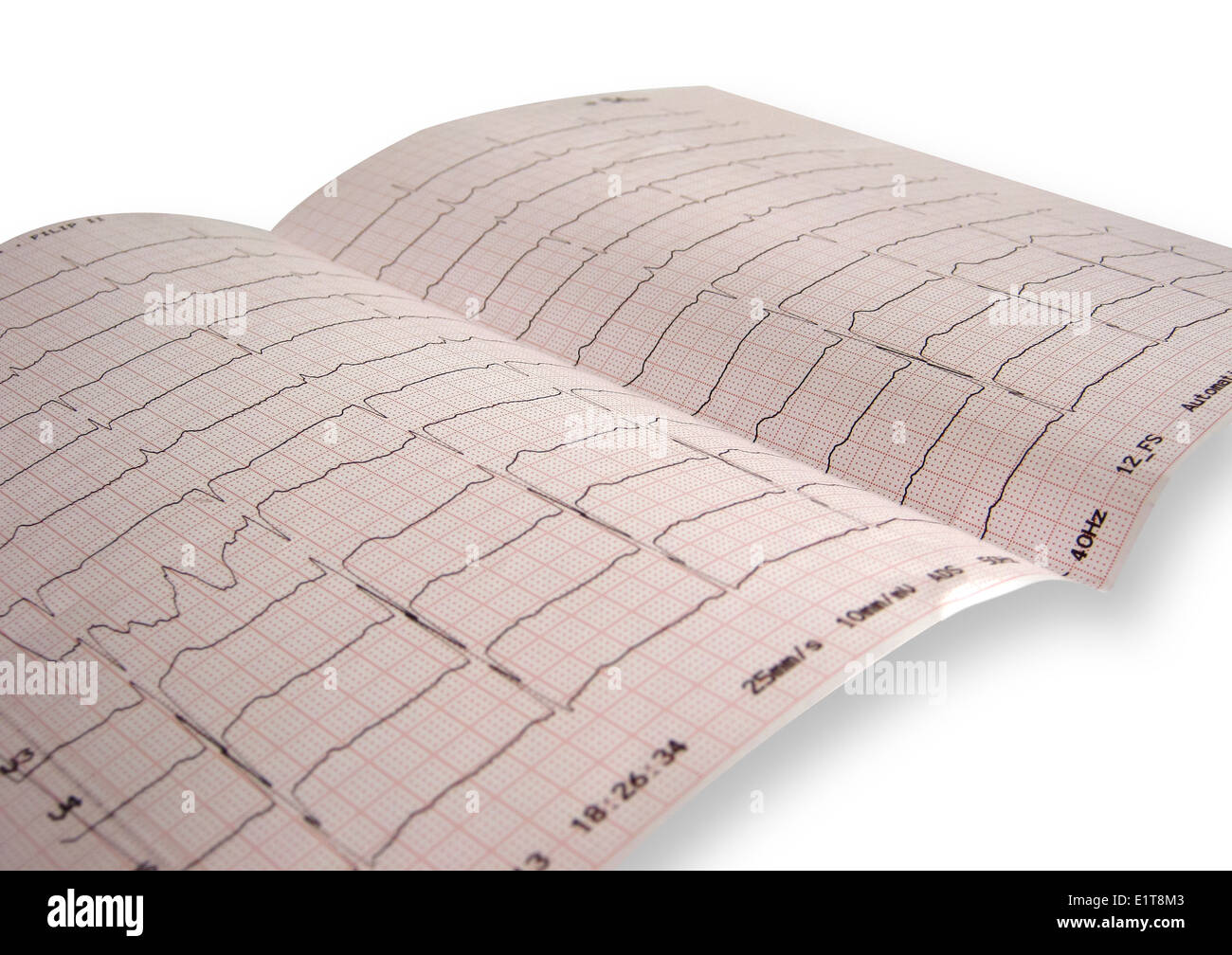 cardiogram isolated on white Stock Photo - Alamy