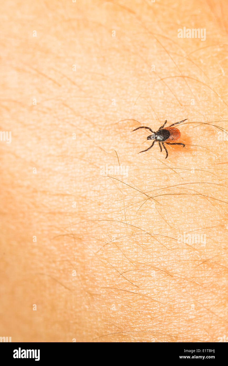 Tick - parasitic arachnid blood-sucking carrier of various diseases ...