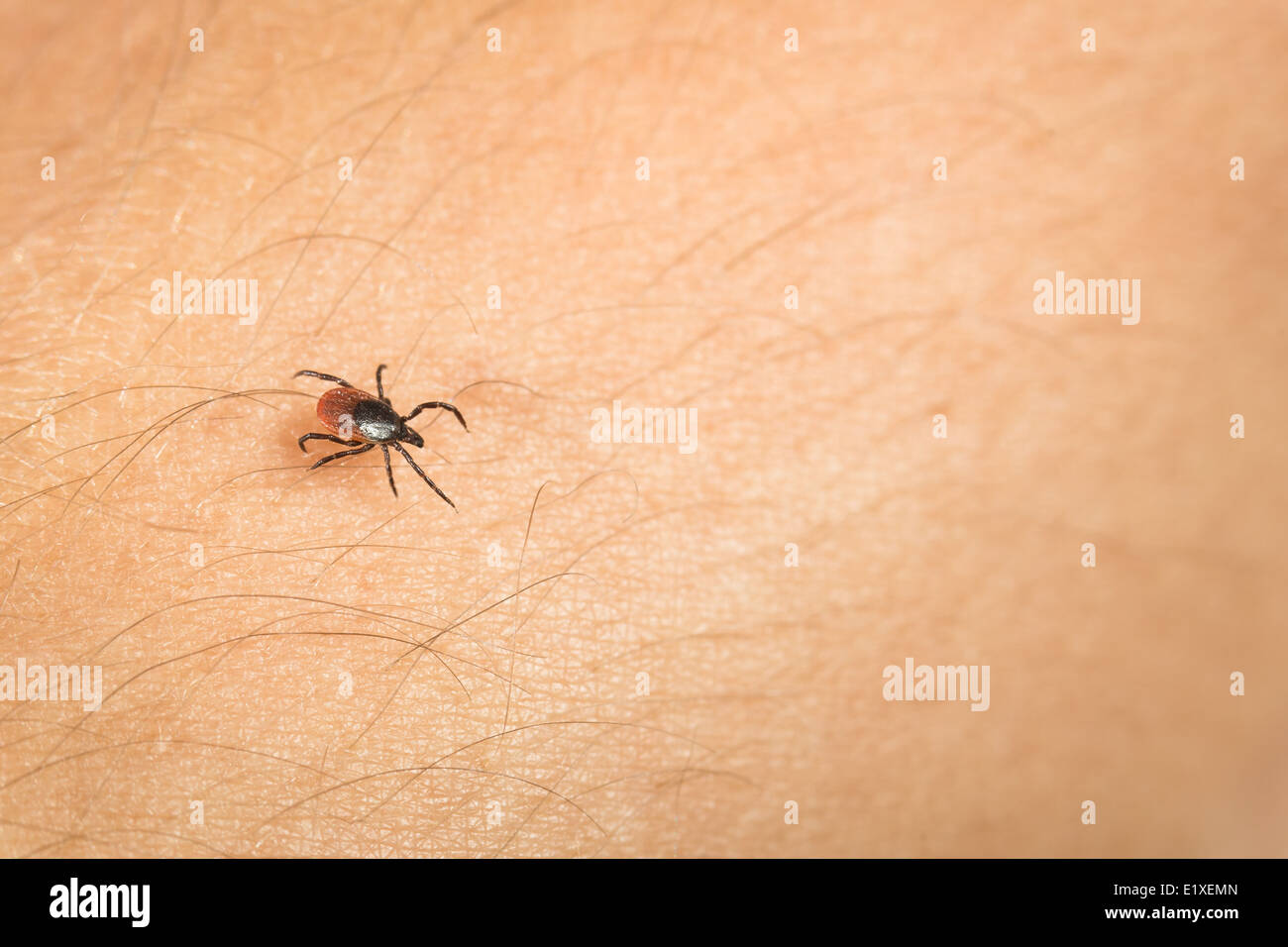 Tick - parasitic arachnid blood-sucking carrier of various diseases ...