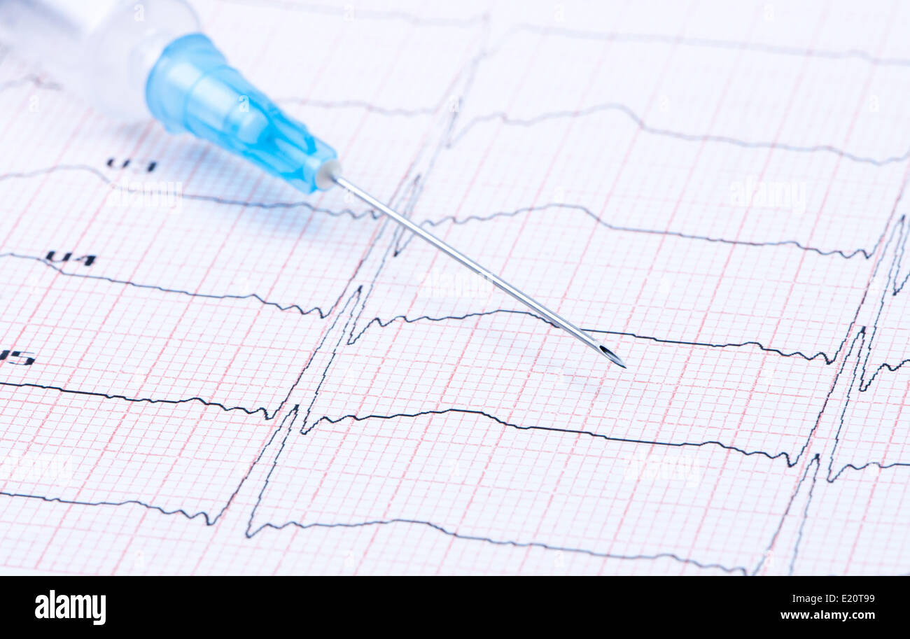 Ecg chart hi-res stock photography and images - Alamy